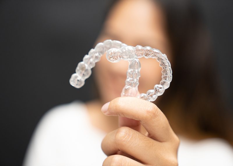 Top Strategies to Keep Clear Aligners Sparkling | Orthodontists