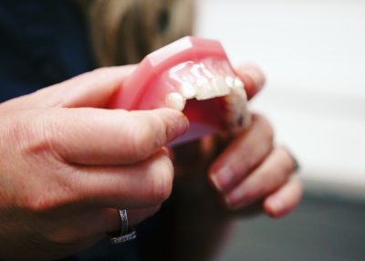 Gainesville & Lake City FL Orthodontists | Invisalign® & Braces